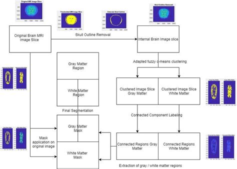Block Diagram Of Automatic Gray And White Matter Segmentation Download Scientific Diagram