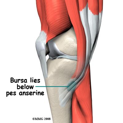 Physiotherapy In Lethbridge For Knee Pes Anserine Bursitis