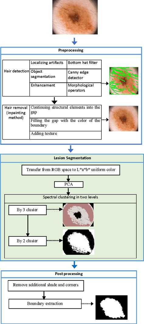 figure 1 from automated lesion border detection of dermoscopy images using spectral clustering