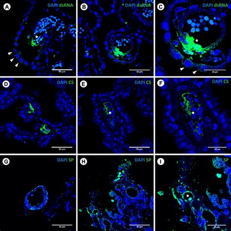 Photomicrographs Of Immunostaining For Sars Cov 2 In Choroid Plexus Download Scientific Diagram