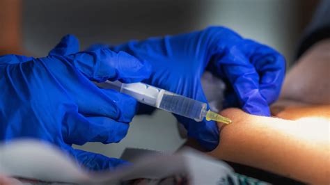 Prolia Dosing Regimen Medica Depot