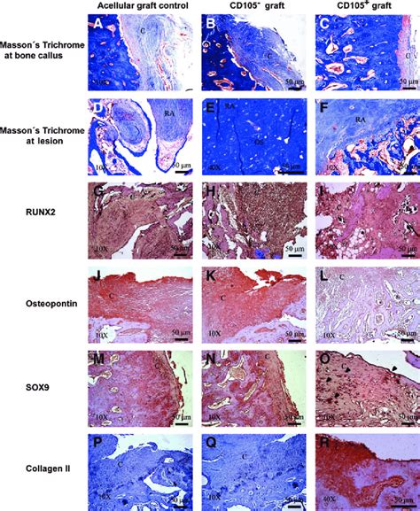Photomicrographs Of Treated Lesions At Fracture Callus Histological Download Scientific