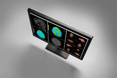 放射学监视器 Barco