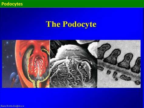 Ppt Podocytes Powerpoint Presentation Free Download Id 1902556