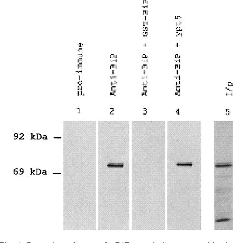 Figure 1 From The Bip Protein And The Endoplasmic Reticulum Of Schizosaccharomyces Pombe Fate