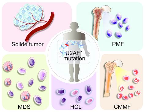 Mutations In U2 Small Nuclear Rna Auxiliary Factor 1 Are Observed In Download Scientific