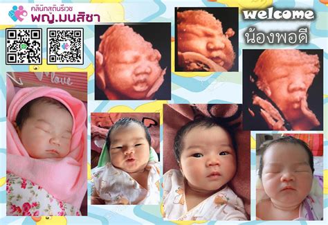 🎉 ยินดีต้อนรับ “น้องพอดี” นะคะ 🎉 🎀 อัลตราซาวน์ 3 มิติ 4 มิติ ทำให้พ่อแม่สามารถเห็นลูกน้อยได้