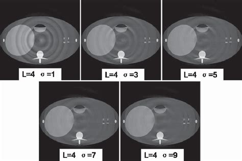Fbp Wavelet Fft Filter With Differernt Damping Factor Download Scientific Diagram