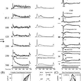 Classification Of Complex Tone Response Types Identified In The Study Download Scientific