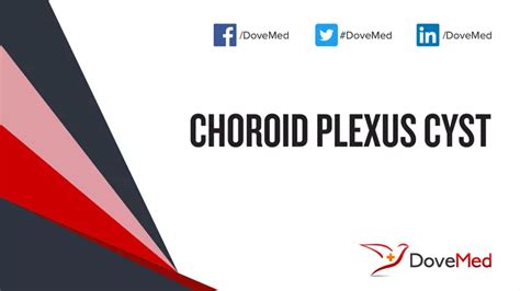 Choroid Plexus Cyst Dovemed