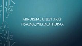 ABNORMAL CHEST XRAY In Icu Care Technology Pptx