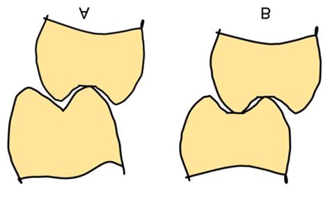 A Single Cusp Tip In Contact With A Flat Surface A A Twin Cusp Download Scientific Diagram