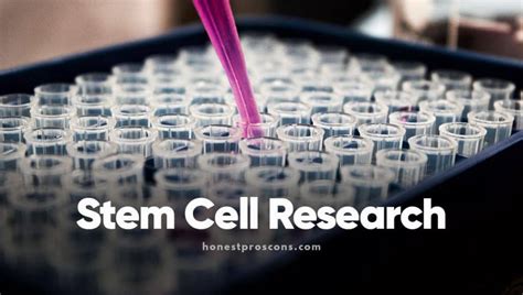 10 Pros And Cons Of Stem Cell Research