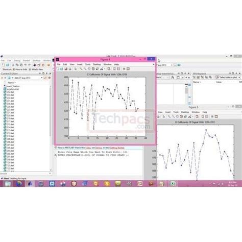 Ecg Based Heart Disease Detection System Techpacs Canada Limited