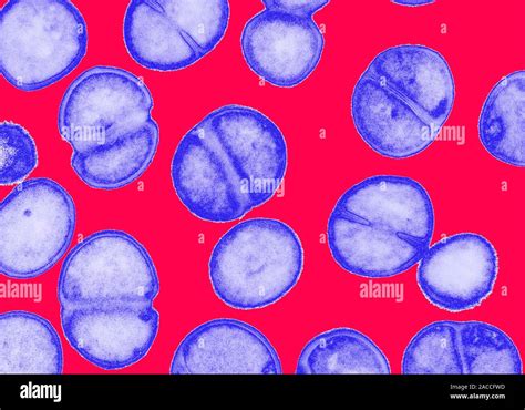 Mrsa Bacteria Coloured Transmission Electron Micrograph Tem Of Methicillin Resistant