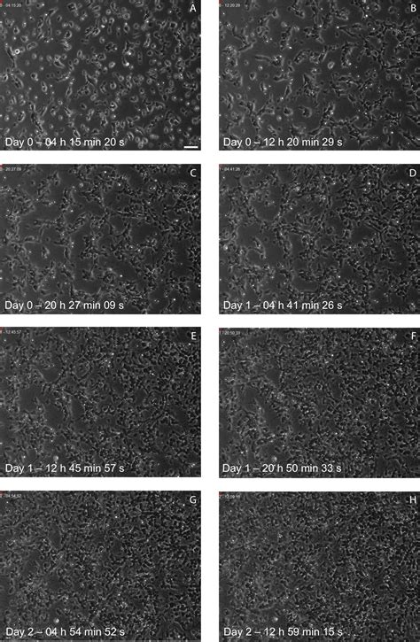 Live Imaging Of Primary Cerebral Cortex Cells Using A 2d Culture System
