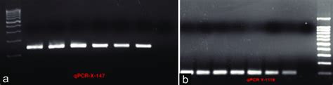 Sybr Quantitative Polymerase Chain Reaction Products Gel Image A Download Scientific Diagram