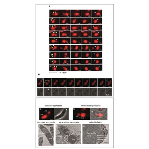 Effects Of Actin Inhibitors On Refractile Body Merger And Morphology Download Scientific