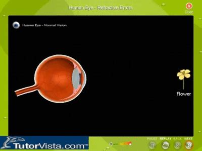 Human Eye Refractive Errors On Make A GIF
