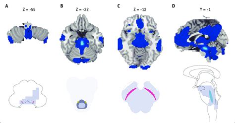 The Locational Relationships Between Lesion Network Mapping For Rapid Download Scientific
