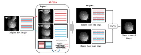 Mr Ghost Artifact Correction Using Aloha Bispl Bioimaging Signal Processing And Learning Lab
