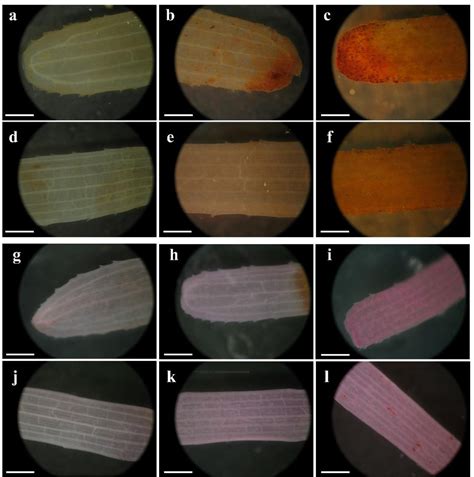 Figure 4 From Polystyrene Micro And Nanoplastics Induce Growth And Physiological Alterations In
