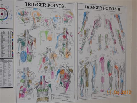 My Trigger Points Charts Trigger Points Chart