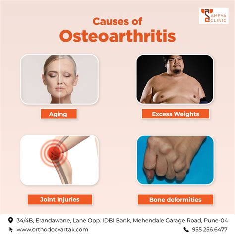 Osteoarthritis Causes And Prevention