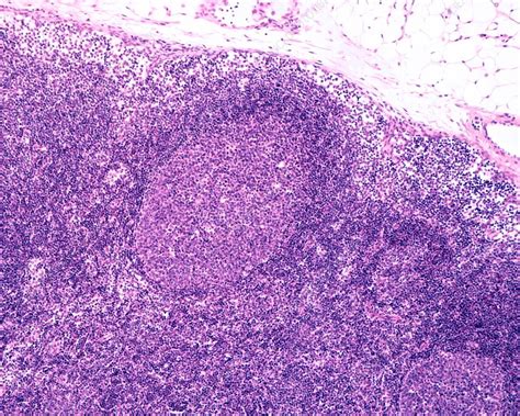 Lymph Node Micrograph