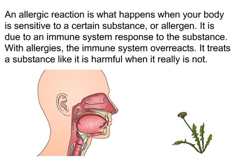 Hives And Angioedema