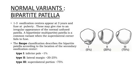 Radiographic Anatomy Of Knee Joint And Its Radiographic Viewspptx