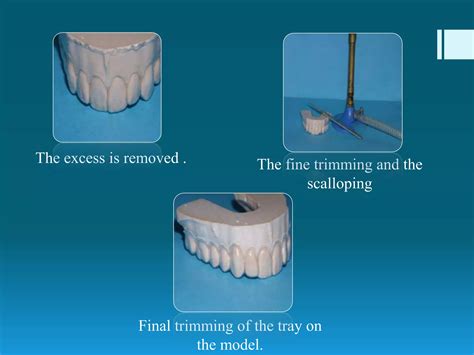 Vital Tooth Bleaching Pptx