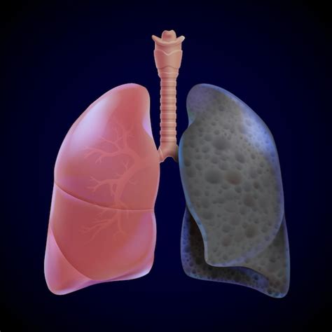 Premium Vector 3d Illustration Of Healthy Human Lungs And Smoking
