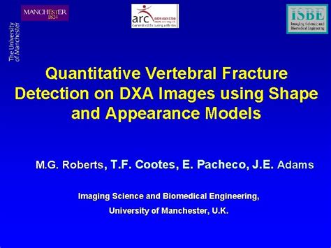 Quantitative Vertebral Fracture Detection On Dxa Images Using