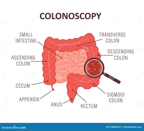 Colonoscopy Concept Intestine Exam And Treatment Bowel Polypectomy
