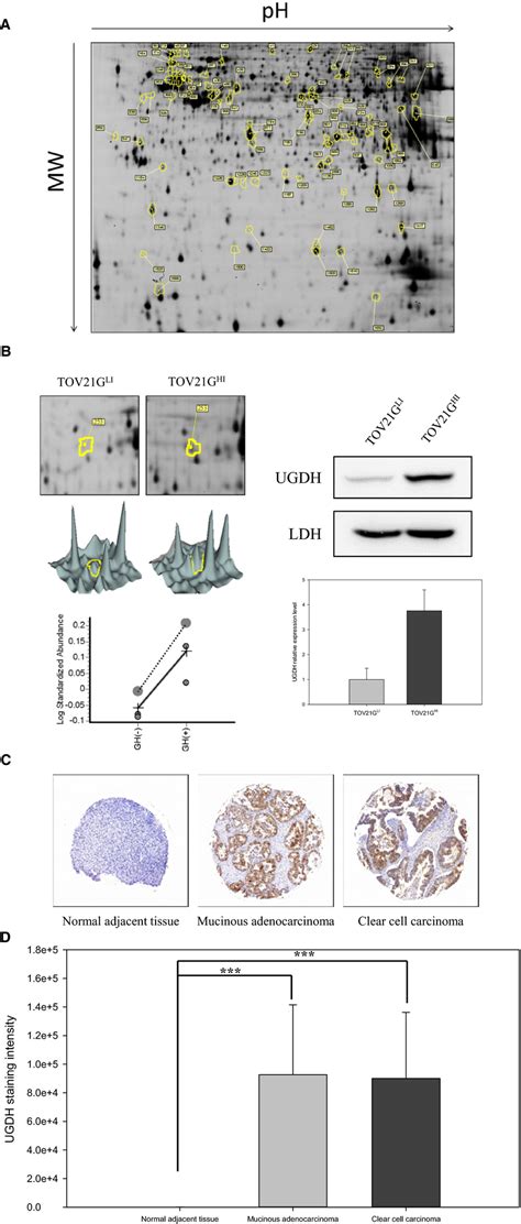 Proteomic Analysis Of Metastasis‐related Proteins And Ugdh Expression