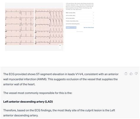 Graham Walker Md On Linkedin 👀look Out Med Palm 2 Here Comes Multimodal Image Chatgpt I Gave…