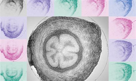 Optics And Photonics News Optical Coherence Refraction Tomography