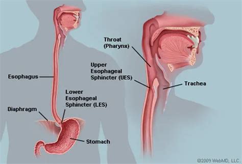 Esophagitis Symptoms And Treatment