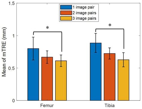 Integration Of Statistical Shape Modeling And Alternating Interpolation