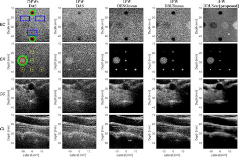 Figure 1 From Ultrasound Imaging Based On The Variance Of A Diffusion Restoration Model