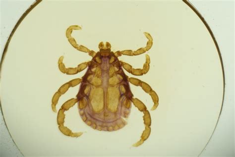 Dermacentor Variabilis Slide
