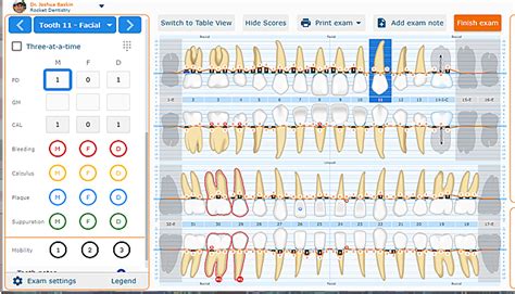 Dental Perio Charting Printable Dental Perio Chart Fo