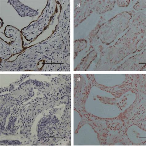 Immunohistochemical Staining In Paraffin Embedded Formalin Fixed Download Scientific Diagram