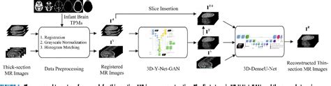 Figure 1 From Deep Generative Adversarial Networks For Thin Section Infant Mr Image