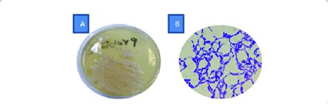 Isolation And Identification Of Lactobacillus Species A Download
