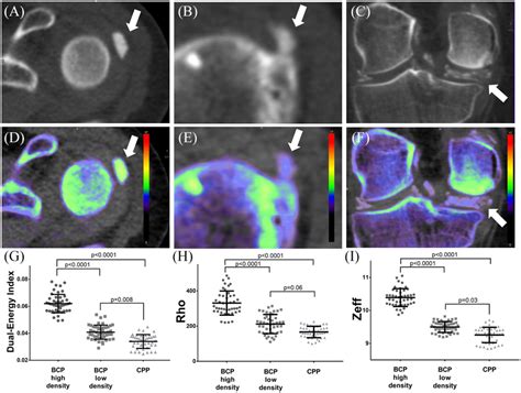 Dual Energy Computed Tomography Dect Scans A D Shoulder Download Scientific Diagram