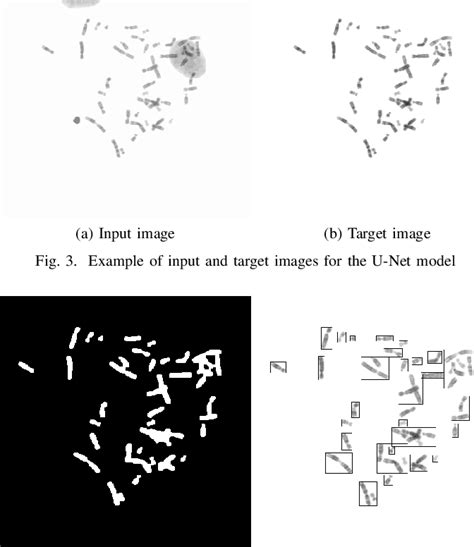 Figure 3 From Deep Learning Pipeline For Chromosome Segmentation