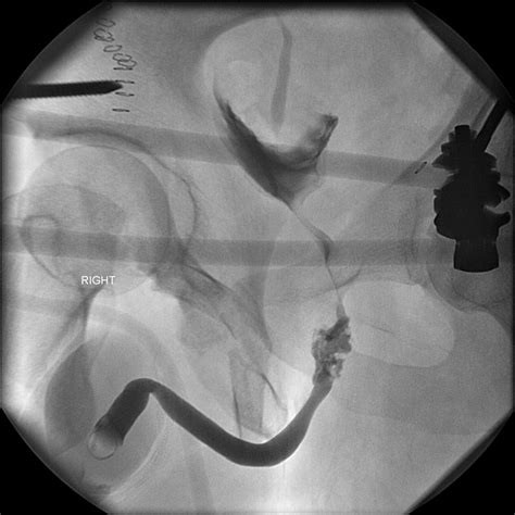 Pelvic Fractures — Kwak Talk