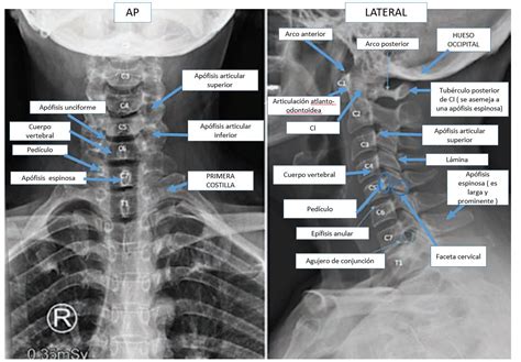 Anatomia Radiografica De Columna Cervical Porn Sex Picture